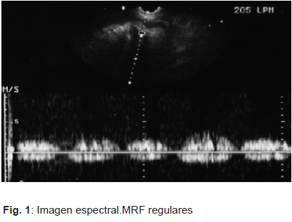 Patrón de los movimientos respiratorios en el feto sano con crecimiento ...