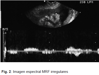 Patrón de los movimientos respiratorios en el feto sano con crecimiento ...