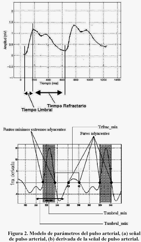 Algoritmo de compresión para la señal de pulso arterial periférico