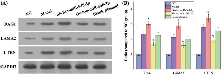 Role and mechanism of miR-548-3p/ DAG1 in the occurrence and malignant ...
