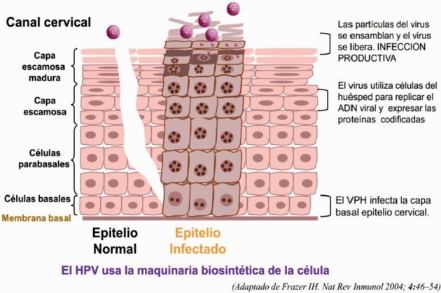 Papel del virus del papiloma humano en el desarrollo del cáncer del ...