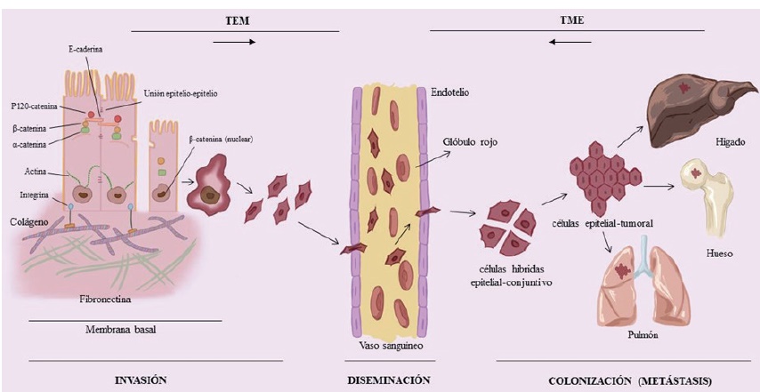 Transición epitelio - mesenquima y cáncer.