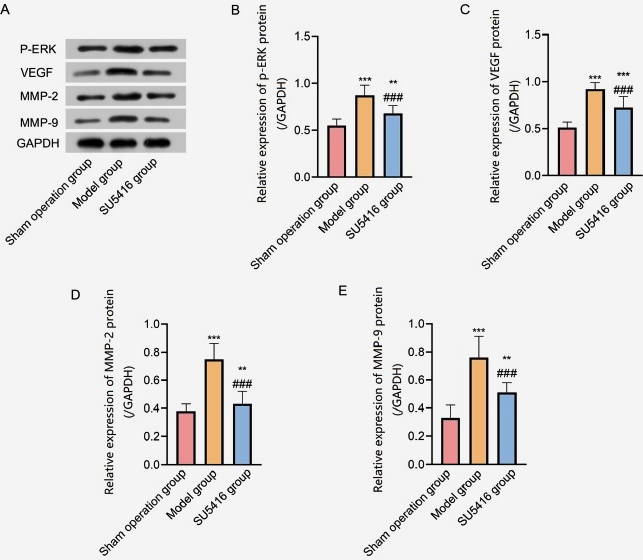 Effects of SU5416 on angiogenesis and the ERK-VEGF/MMP-9 pathway in rat ...