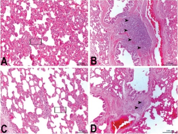 Pulmonary toxicity associated with high-dose favipiravir and treatment ...