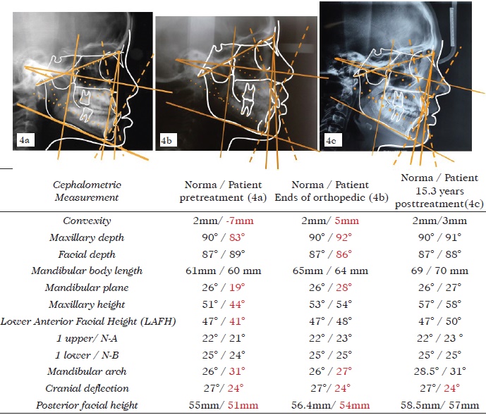 Prediction of the individual response to treatment of skeletal Class ...