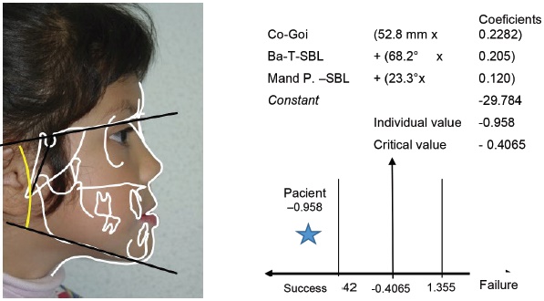 Prediction of the individual response to treatment of skeletal Class ...