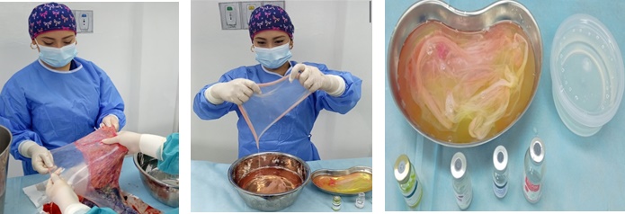 Amnios con cobertura antibiótica: eficacia en pacientes sometidas a ...